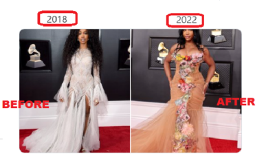 SZA BBL: Did SZA Get A BBL? SZA BBL Before And After!